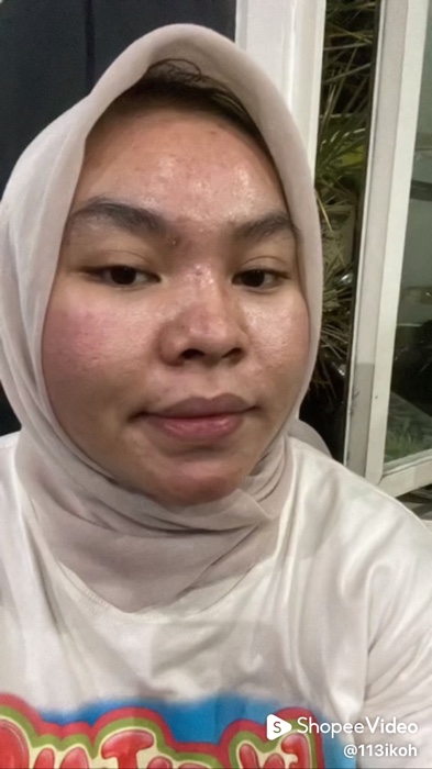 Buat yang punya permasalahan kulit sama kaya aku sensitif, kemerahan, berminyak. moisturizer ini ...