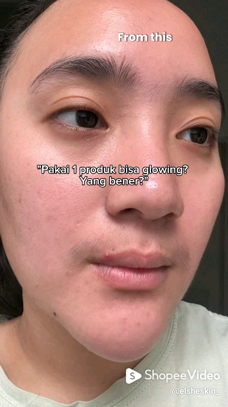 yuk checkout! #elsheskin | Shopee Video Indonesia