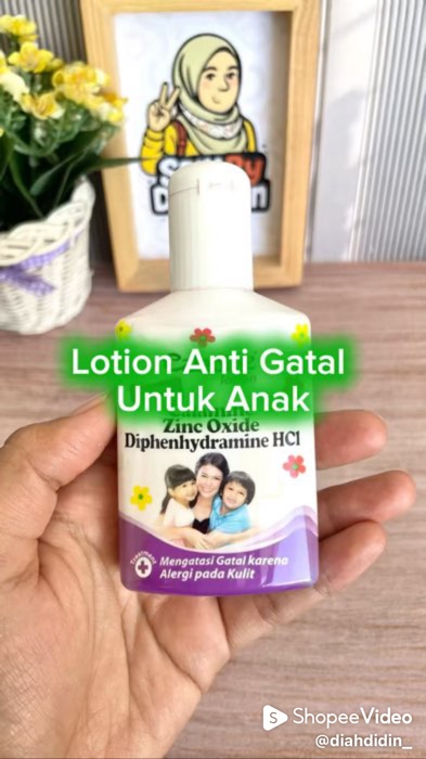 Lotion anti gatal | Shopee Video Indonesia